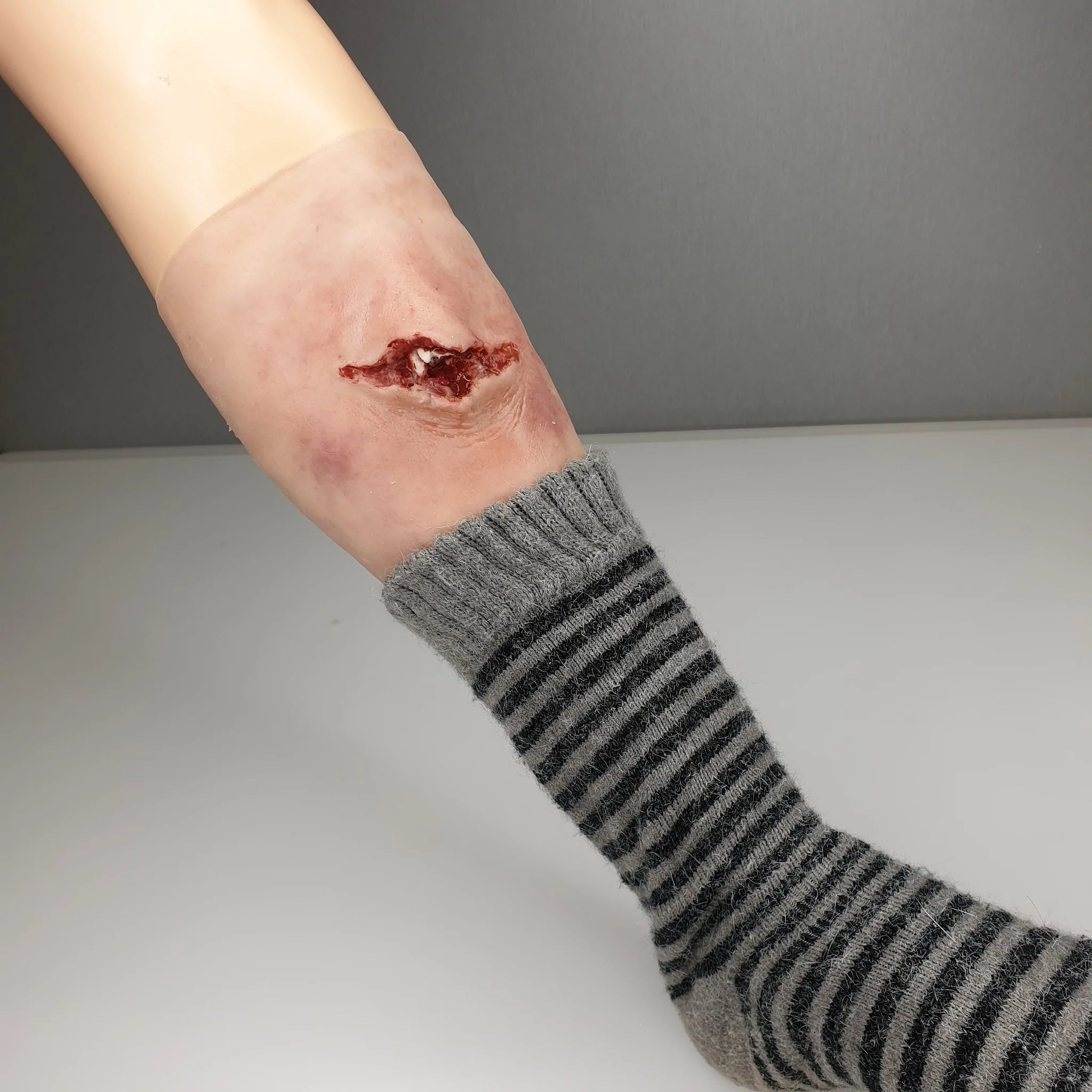 MT006 Open Tibia Fracture – Simovation