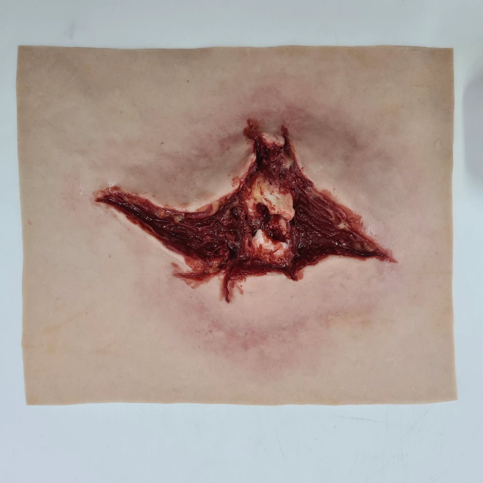 MT001 Open Fracture Trauma – Simovation